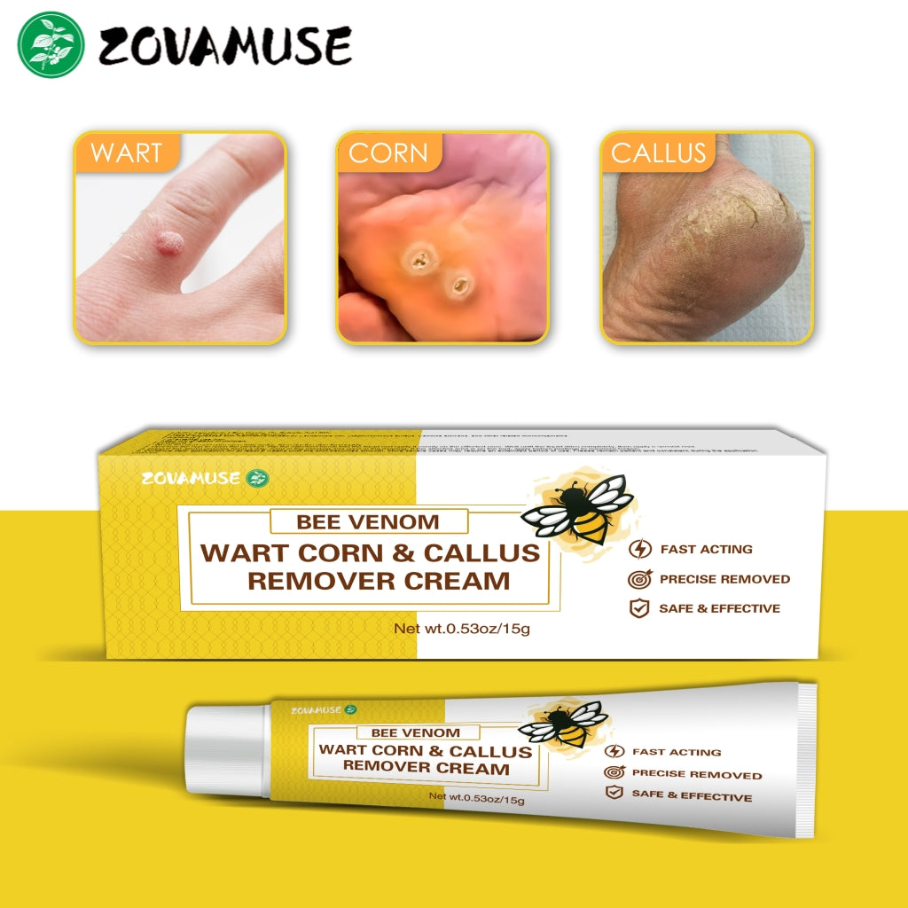 Bee Venom Corn & Callus Remover Cream – ZOVAMUSE